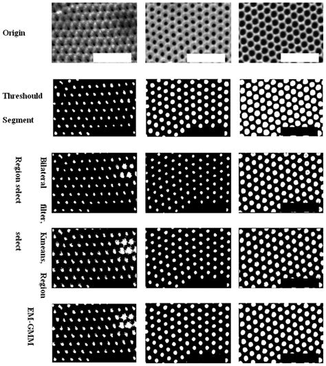 Four Segmentation Methods For Three Scanning Electron Microscope Images