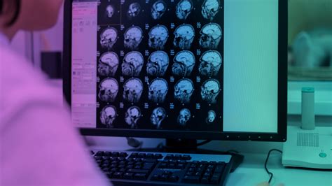 How Concussions Are Diagnosed Expert Insights And Key Tools Complete