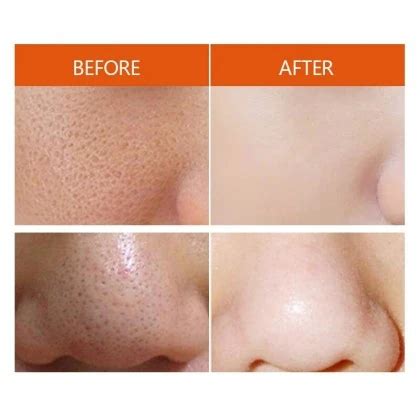 Top 6 Steps To Unclog Your Pores Refine Your Skin Healthy Beautiful