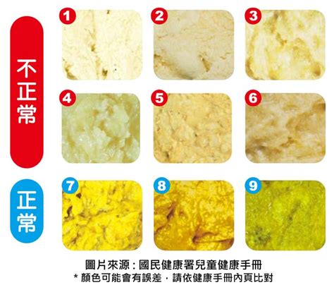 〈幸福安婦幼專欄〉新手爸媽從排便頻率、顏色和質地看寶寶的健康情形