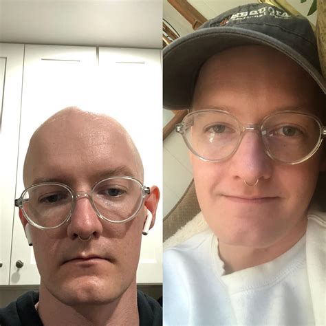 [mtf] Left Day 1 Hrt Right Day 102 Scrolller