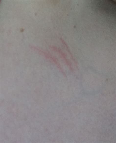 Page 3 To Think A Demon Has Attacked Me In My Sleep Mumsnet