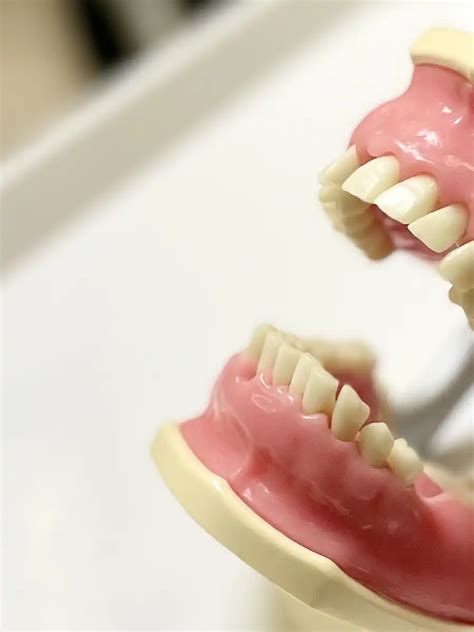 Gum Disease Anthony Dental