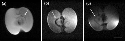Vertical Slice Images Acquired By The Single Slice 2 D Gradient Echo Download Scientific
