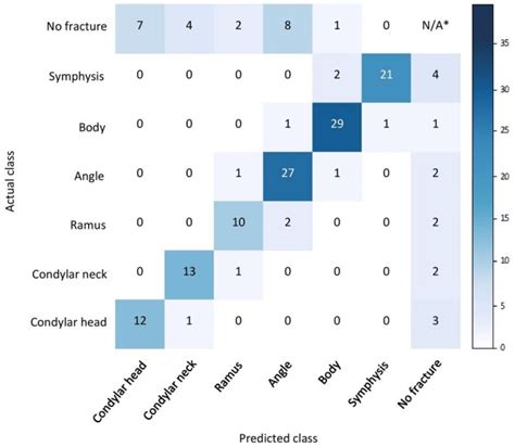 Detection And Classification Of Mandibular Fractures In Panoramic Radiography Using Artificial