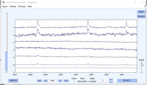 Eeglab 脑电数据处理与分析eeglab中怎么样进行特征分析 Csdn博客
