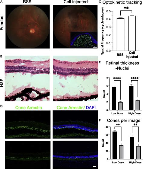 Rpe Transplantation In Rcs Rats A And B Fundus Imaging A And H And E Download Scientific