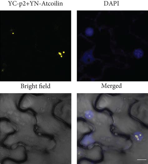 Bimolecular Fluorescence Complementation Bifc Assay Showing Download Scientific Diagram