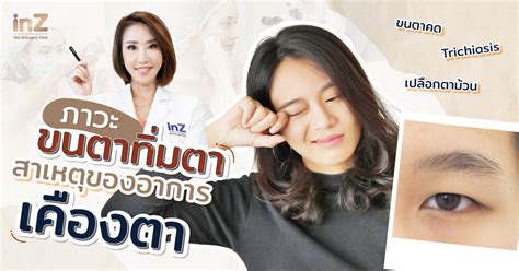 ภาวะขนตาทิ่มตา สาเหตุของอาการเคืองตา แก้ไขอย่างไรได้บ้าง Inz Clinic