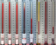 Sed Rate Test IYTmed Com