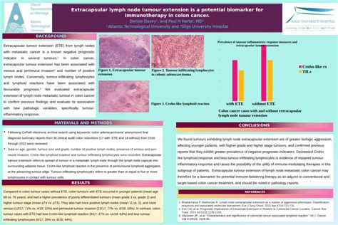 Pdf Extracapsular Lymph Node Tumour Extension Is A Potential Biomarker For Immunotherapy In