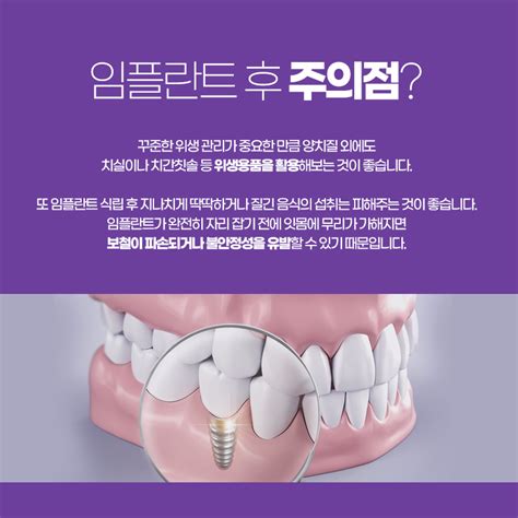 강남역치과 임플란트 주위염 증상과 치료 방법 무엇일까 네이버 포스트