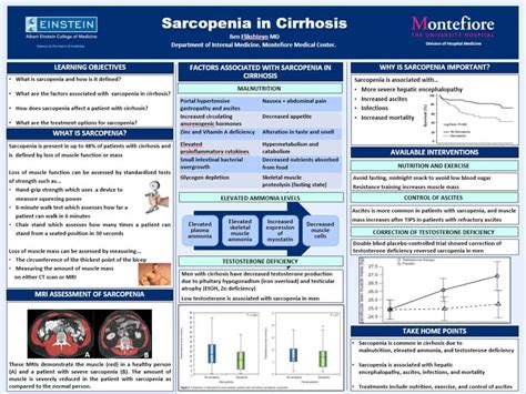 Sarcopenia In Cirrhosis American Liver Foundation