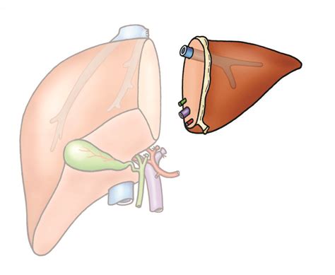 Information For Potential Living Liver Donors Leeds Teaching Hospitals Nhs Trust