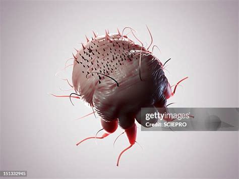 Scabies Mites Photos And Premium High Res Pictures Getty Images