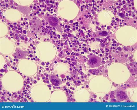 Menselijk Beenmerg Onder De Microscoop Stock Afbeelding Image Of