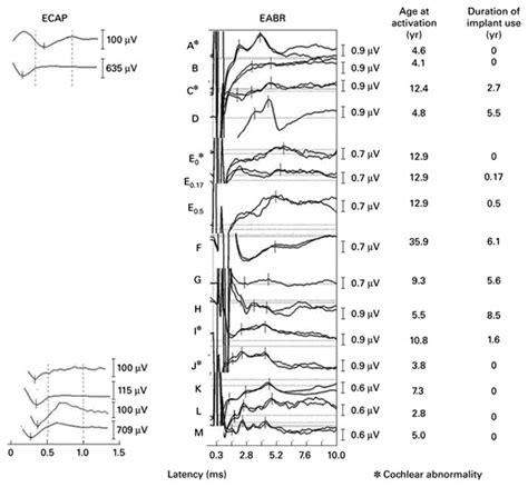 the ecap and eabr waveforms from participants a h corresponding to the download scientific