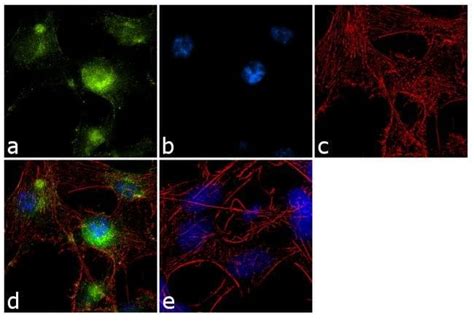 Glur2 Monoclonal Antibody 6c4 Invitrogen 100 μg Unconjugated