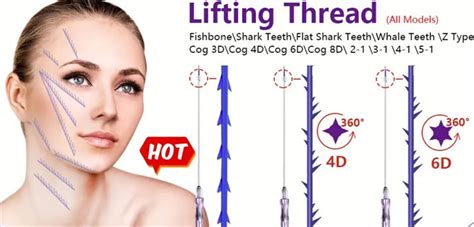 중국 저가형 한국 Pdo 스레드 리프트 제조업체 공급 업체 공장 맞춤형 서비스