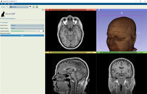 Slicercat Creating Custom Applications Based On 3d Slicer