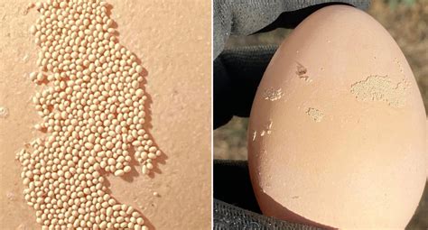 Strange Lice Egg Bumps Found On Eggs In Australia The Happy Chicken
