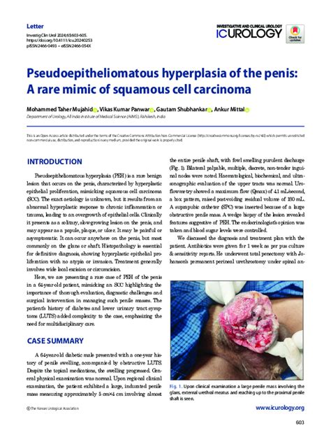 Pdf Pseudoepitheliomatous Hyperplasia Of The Penis A Rare Mimic Of