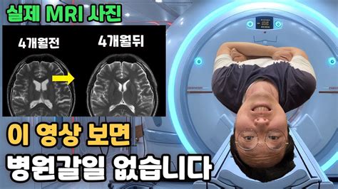 4개월만에 두뇌가 젊어진 제일쉬운 비결 습관 Youtube