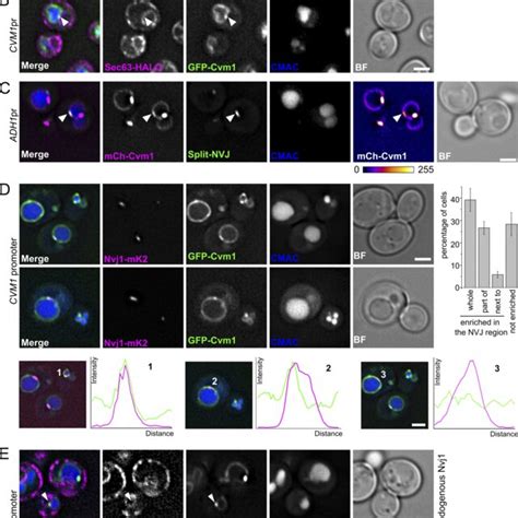 Cvm1 Localizes At The Nvj A And B Fluorescence Microscopy Analysis