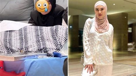 Kronologi Stevia Agnecya Minta Rontgen Hingga Tahu Dirinya Disantet Berawal Pertanyaan Dokter