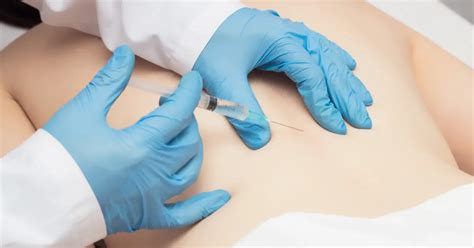 Facet Joint Injection Guide Benefits Procedure And Recovery