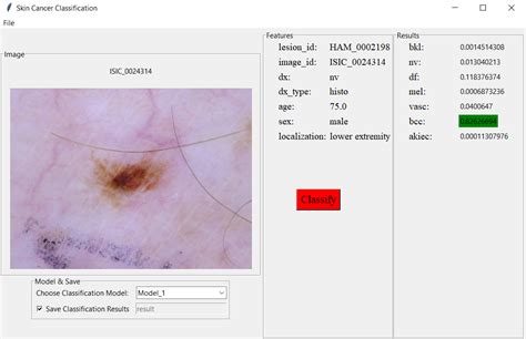 Github Tohid Yousefiguipythonskincancerclassificationproject