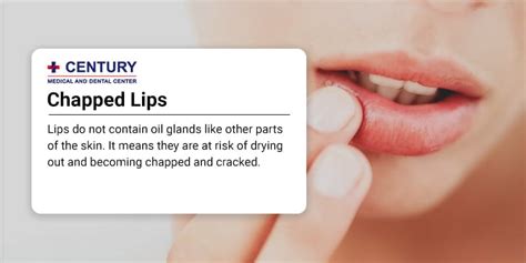 Why Are My Lips Always Chapped Century Medical Dental Center