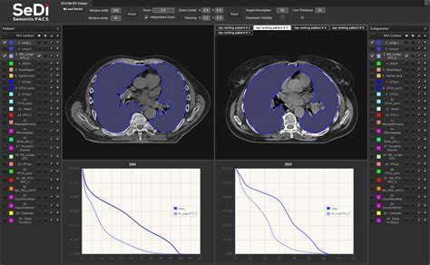 dicom rt viewer sedi semantic pacs