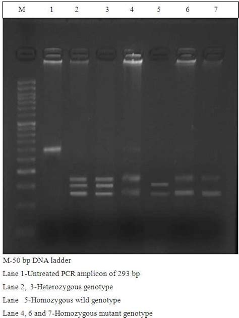 Pcr Restriction Fragment Length Polymorphism Analysis Pcr Rflp Of Download Scientific Diagram