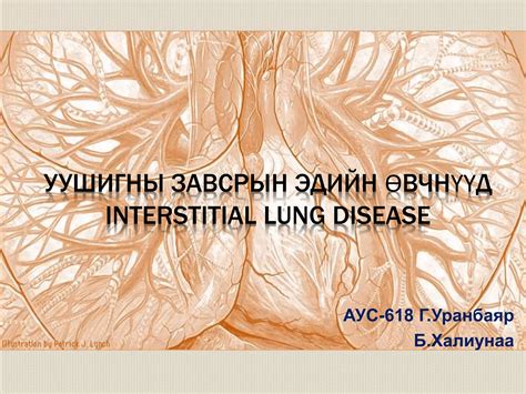 уушигны завсрын эдийн өвчнүүд Pptx