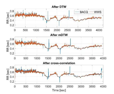 Aligned Rr Signals From Bacq And Wws After Dtw Mdtw And Download Scientific Diagram