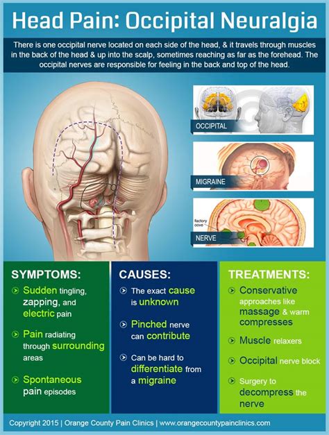 Pin On Headaches