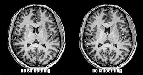 Anatomically Informed Spatial Smoothing Layer Fmri Blog