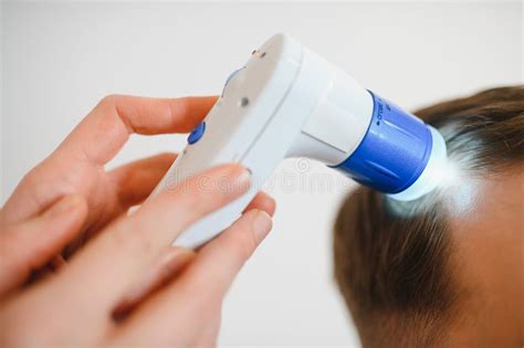 Female Doctor Looks At A Man S Scalp With A Dermatoscope Diagnosis Of Scalp Condition By A