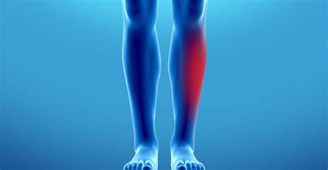 How Shin Splints Occur And How To Relieve Pain East Cork Physio
