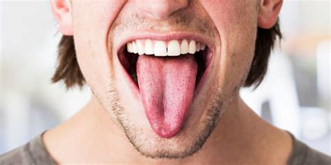 Yeast Infection On Lips Symptoms