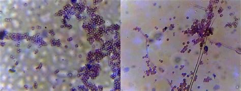 Microscopic Image Of Staphylococcus Aureus Download Scientific Diagram
