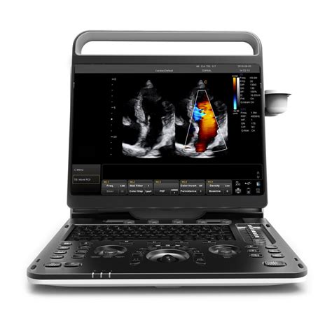 Chison Ebit30 4d 5d Portable Color Doppler Digital Dianostic Imaging