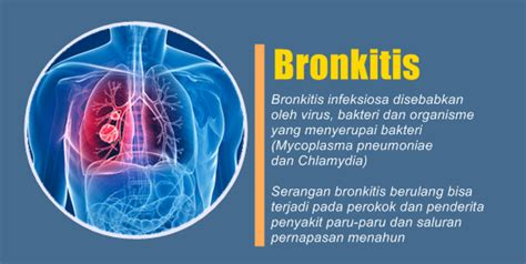 Bronkitis Masalah Kesehatan