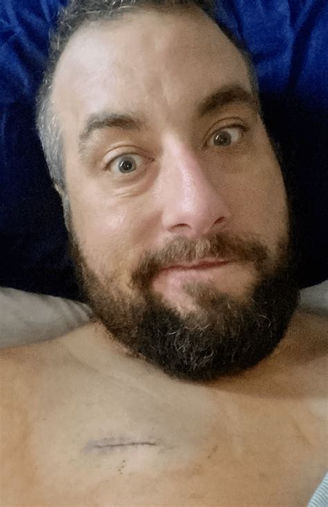 Shocking Diagnosis Of Dlbcl Joining Your Ranks Starting My Treatment