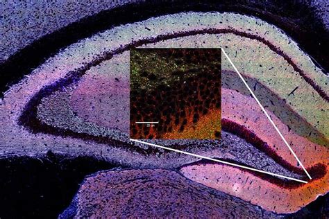 Dragonfly Confocal Microscope System Andor Oxford Instruments