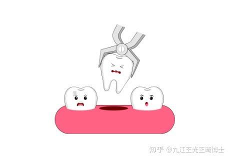 正畸到底要不要拔牙 知乎