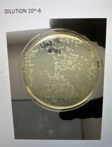 Part Total Count Calculate The E Coli Cells Per Chegg Com