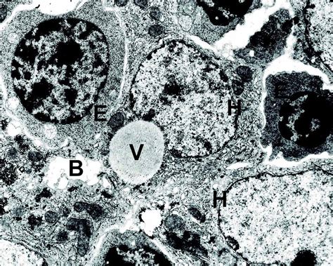 Transmission Electron Micrograph Showing Dz Mouse Fetal Liver Download Scientific Diagram