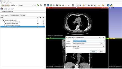 converting dcm to nii gz support 3d slicer community